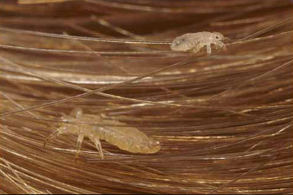 Jardin de Niños Itzel: TRATAMIENTO Y PREVENCIÓN DE LOS PIOJOS