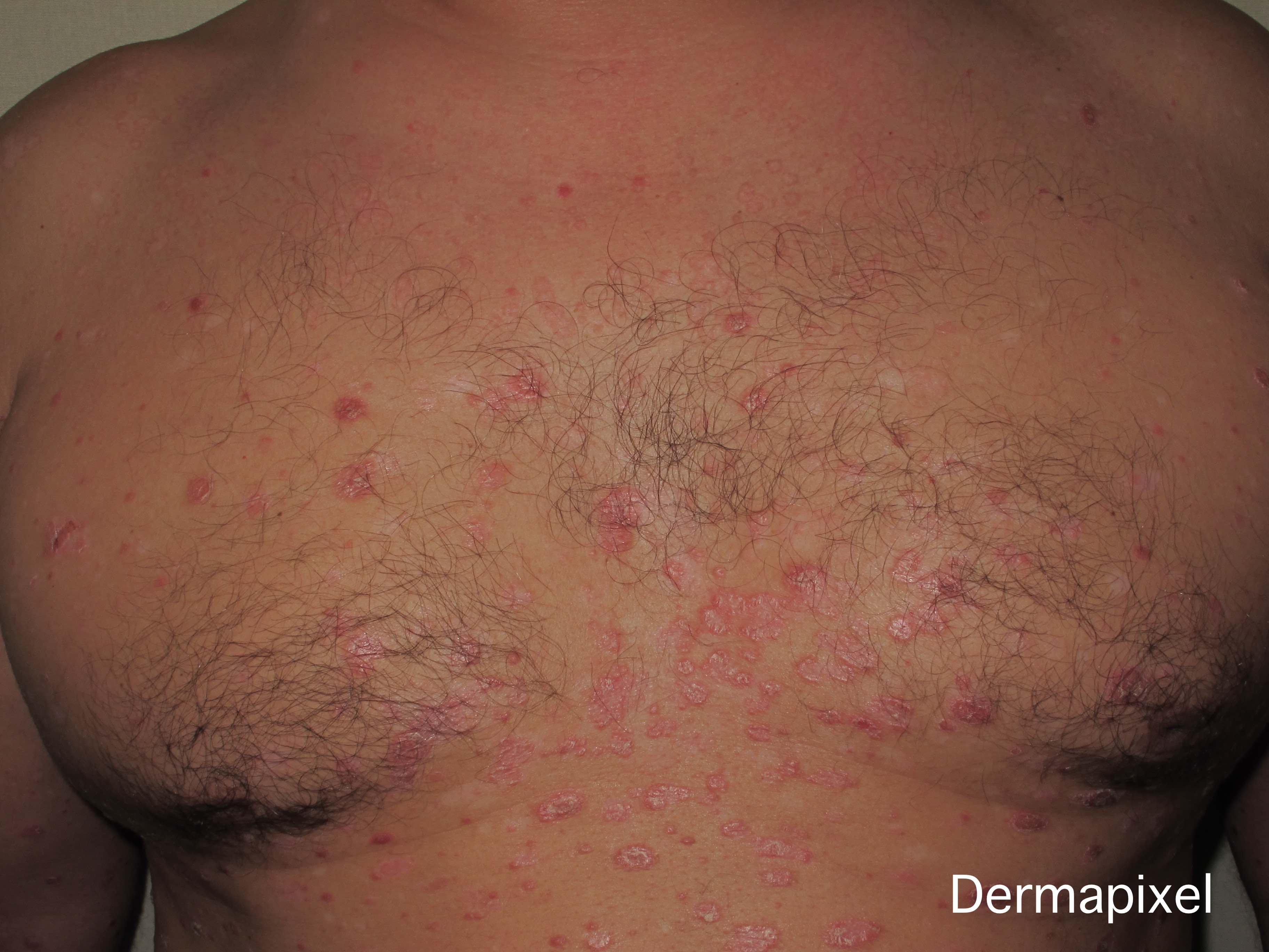 Dermapixel: febrero 2021