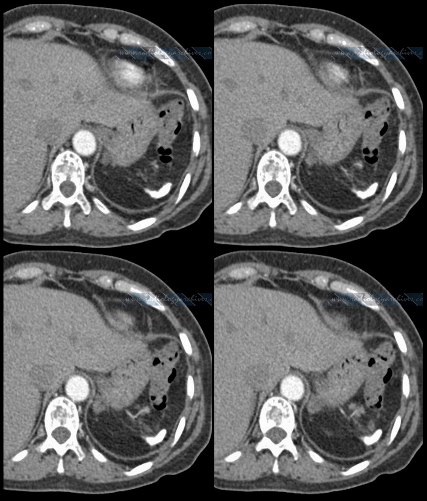 Radiology Archives: Δεκεμβρίου 2015