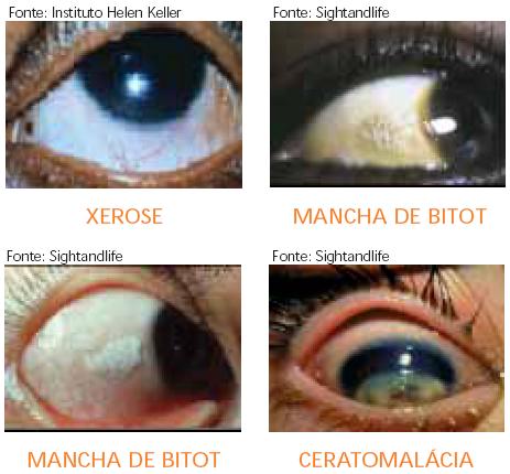 Vitaminas e Minerais: Vitamina A