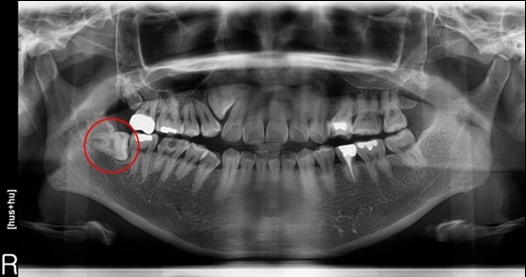 US Certified Dentist: Hsu'hu NEWYORK Dental Clinic - Should I have a ...