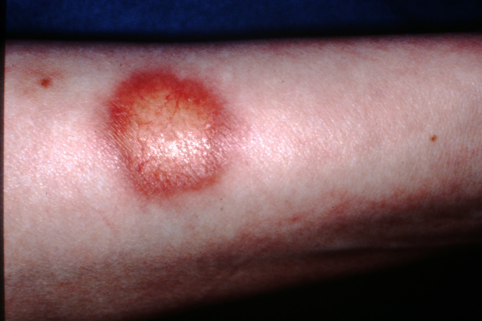Derm Challenge: November 2012