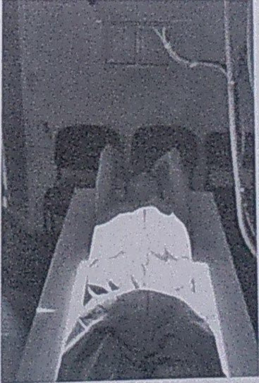 Flexandertes S.A. (sobreoficial asociado): Tallo de abdomen de estómago