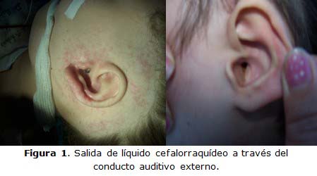 SVB - Soporte Vital Básico + DEA: Signos identificables de FRACTURA de ...