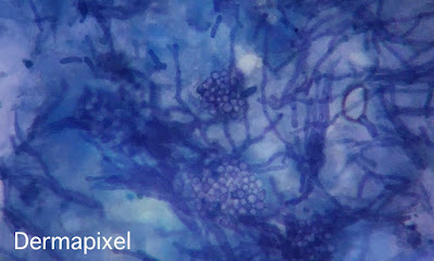 Dermapixel: mayo 2021