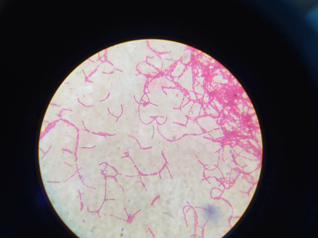 Experiment 6: Preparation of bacterial smear, Experiment 7: Simple ...