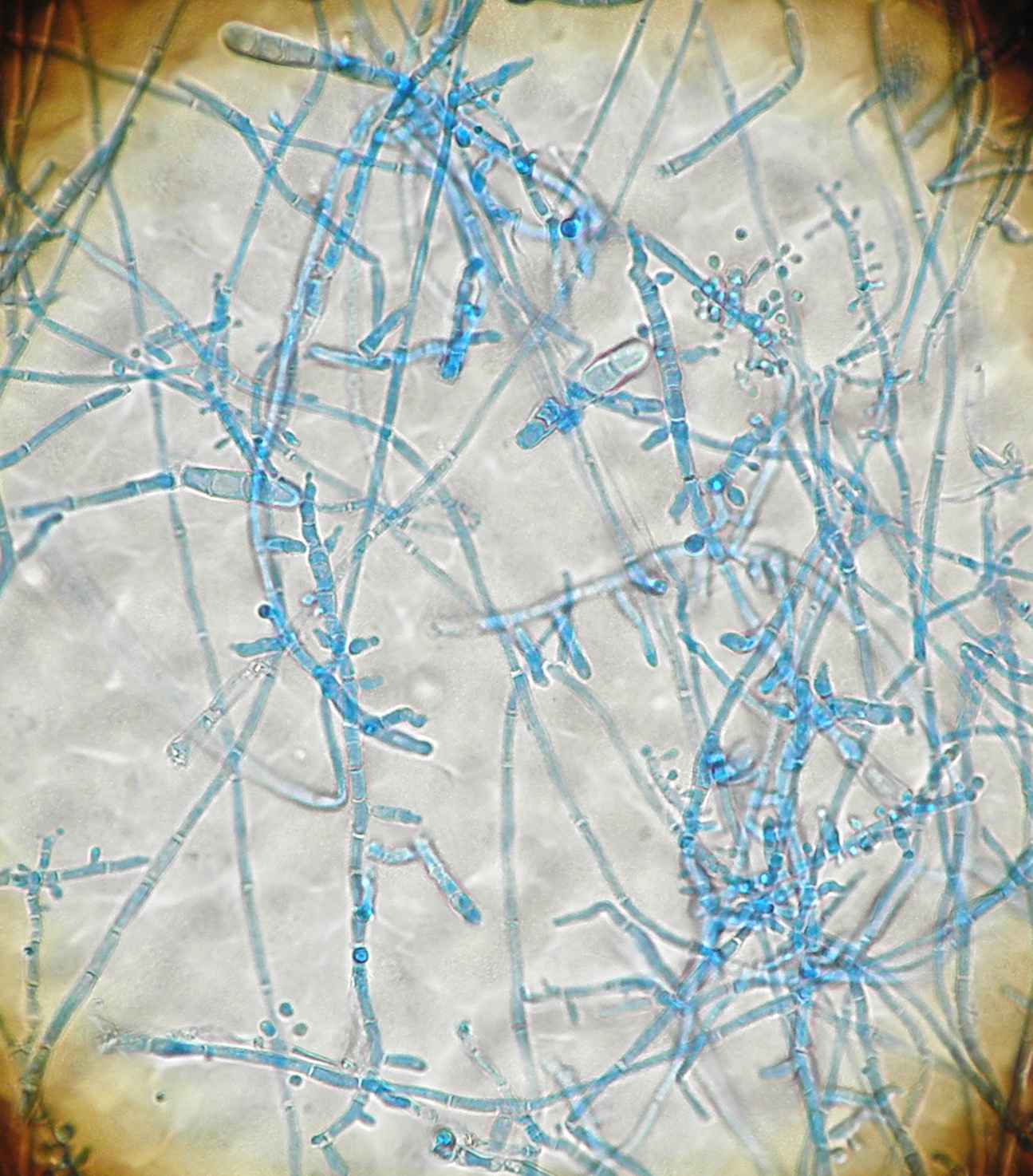 ATLAS MICOLOGIA: TRICHOPHYTON INTERDIGITALE