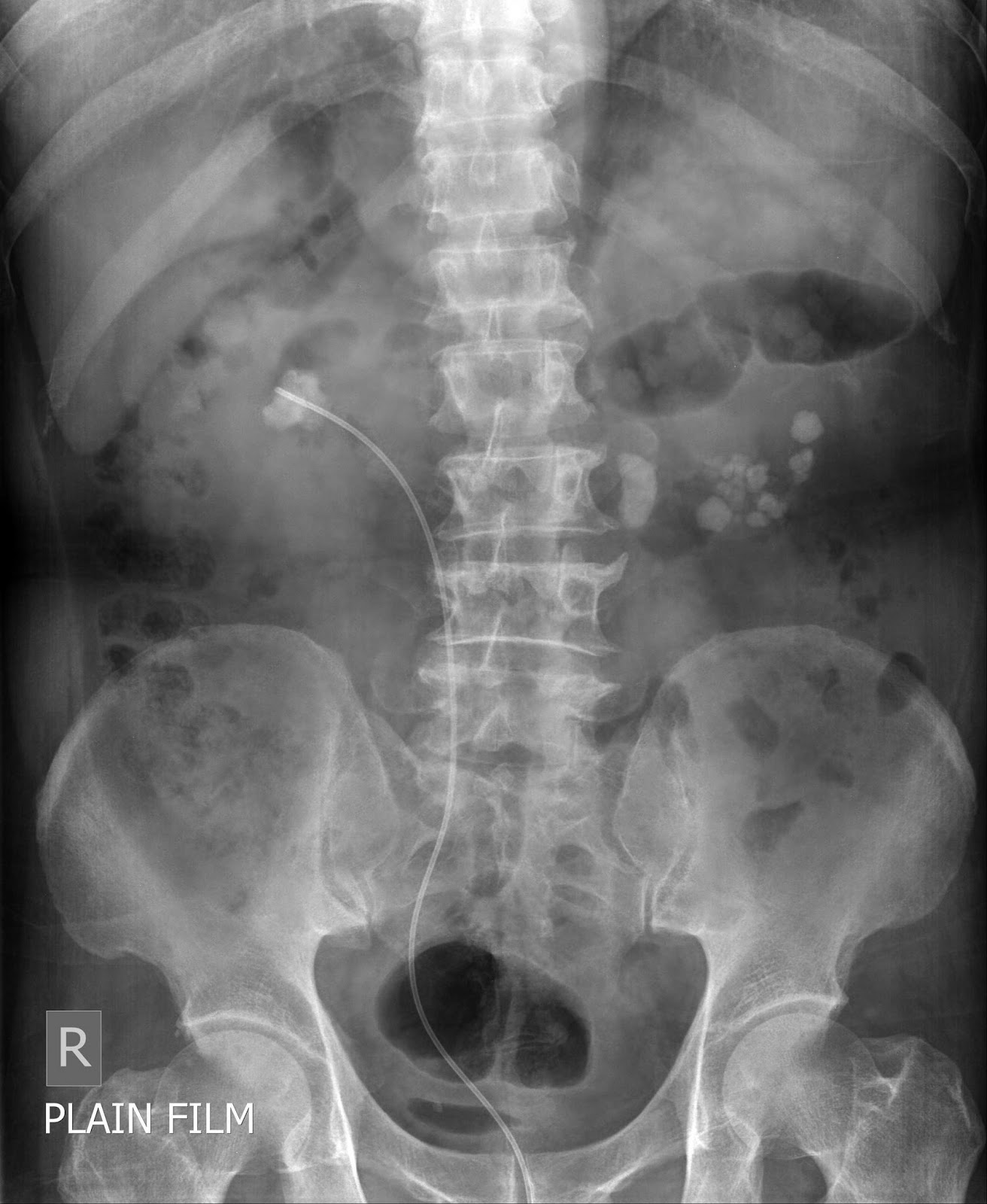 ความรู้เรื่อง plain film