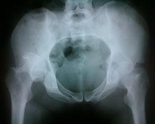 Indahnya Radiologi: Pemeriksaan Pelvis