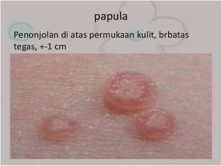 MATERI IPPD SMK PERAWAT KELAS XII: PENGKAJIAN FISIK DAN PEMERIKSAAN ...