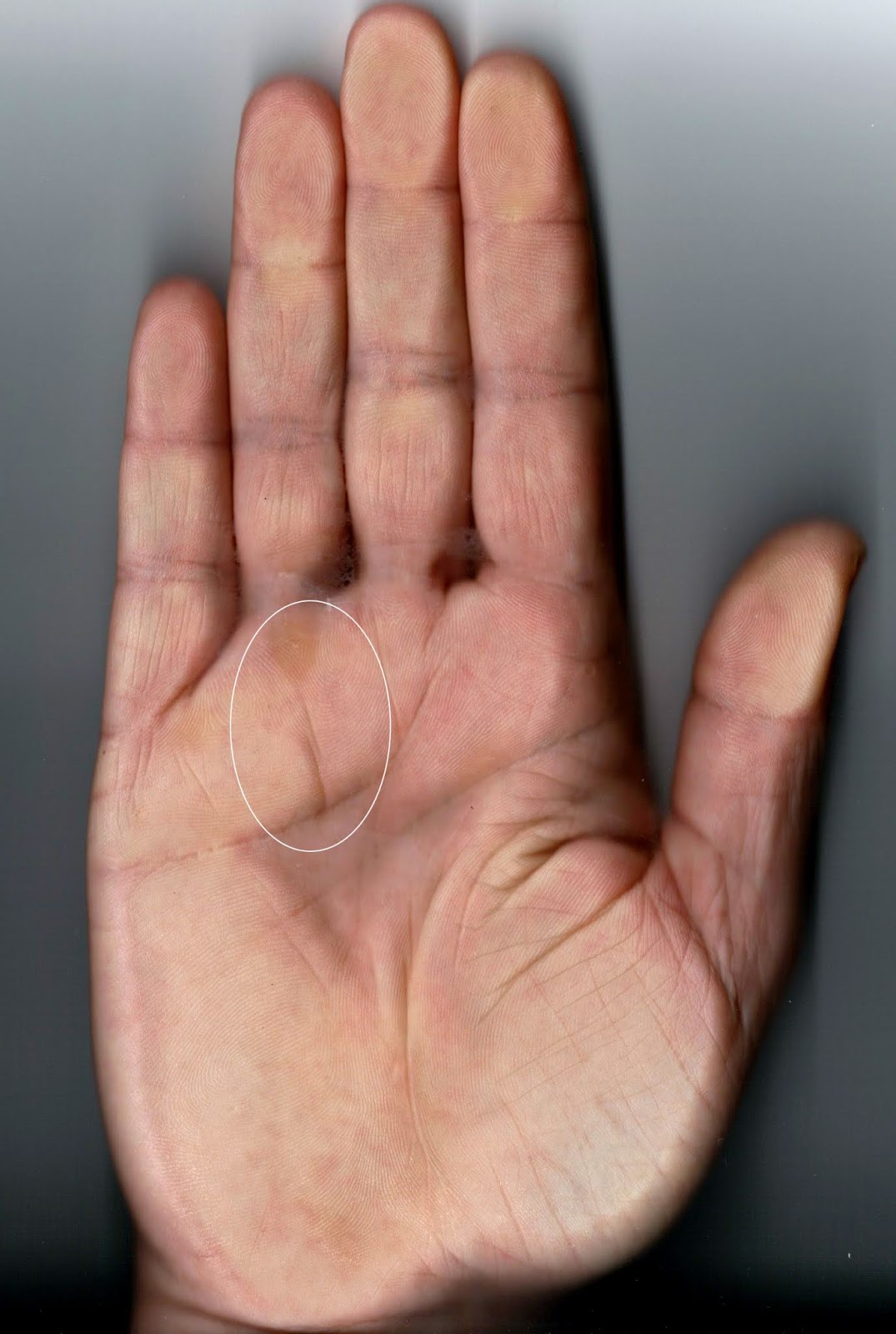 Tooti Hui Surya Rekha Hastrekha Gyan ~ INDIAN PALMISTRY | PALM READING ...