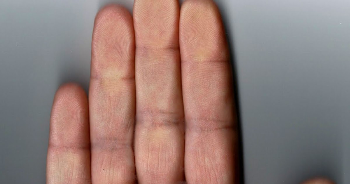 Tooti Hui Surya Rekha Hastrekha Gyan ~ INDIAN PALMISTRY | PALM READING ...