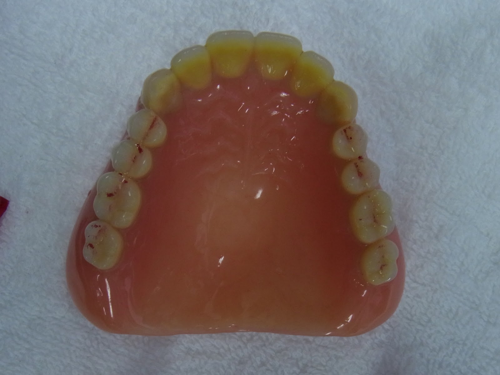 Enjoy dentist life!: Blade teeth for full denture