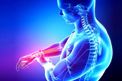 Câncer ósseo: conheça os tipos, sintomas e tratamentos - Portal ...