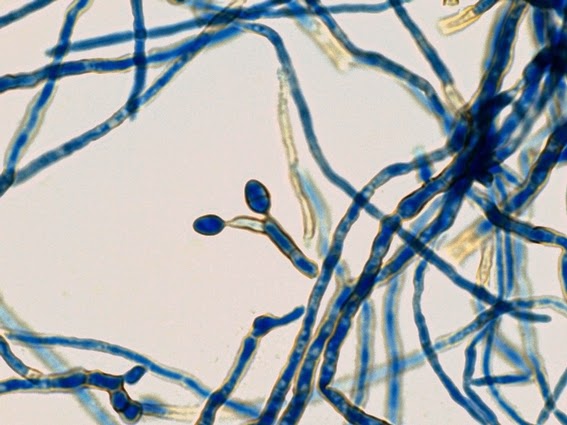 Fun With Microbiology (What's Buggin' You?): Ochroconis species