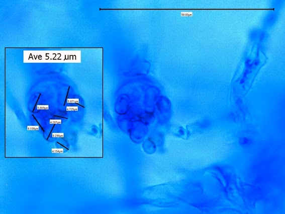 Fun With Microbiology (What's Buggin' You?): Apophysomyces elegans ...