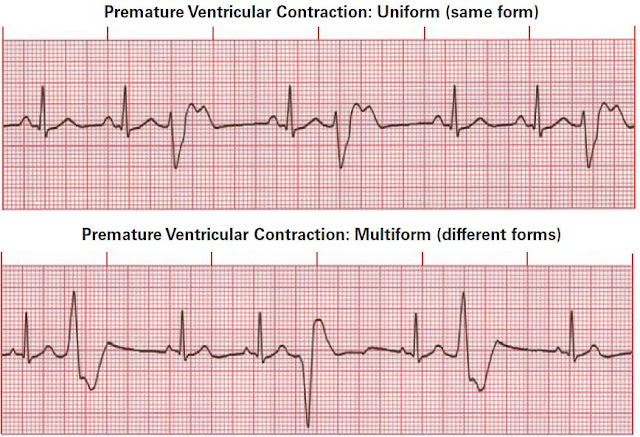 December 2012 - JANTUNG OKE