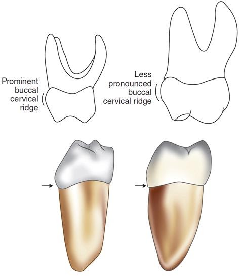 Comparison between permanent and deciduous teeth l Oral morphology MCQs ...