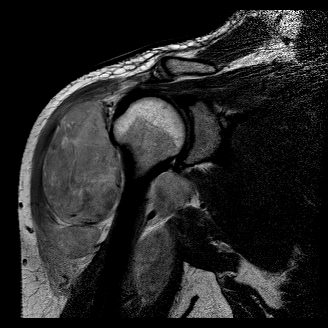 RADIOLOGIA RMC-KODA: octubre 2016