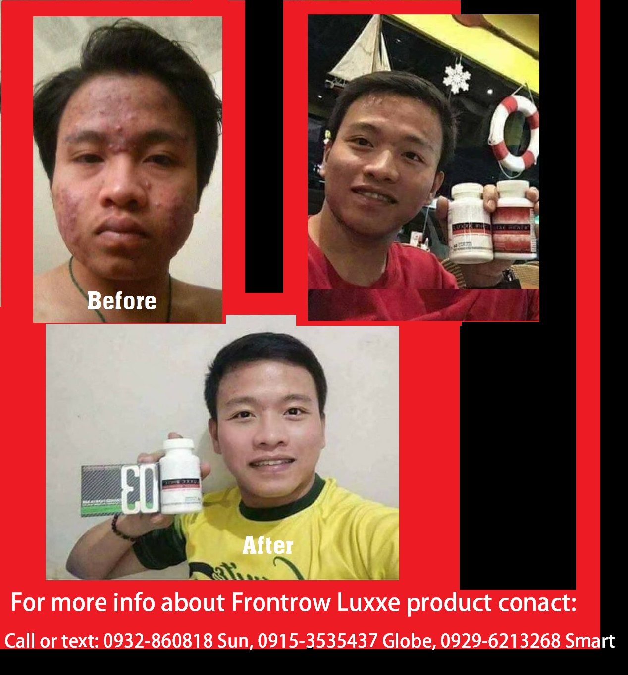 Frontrow Luxxe product before and after use