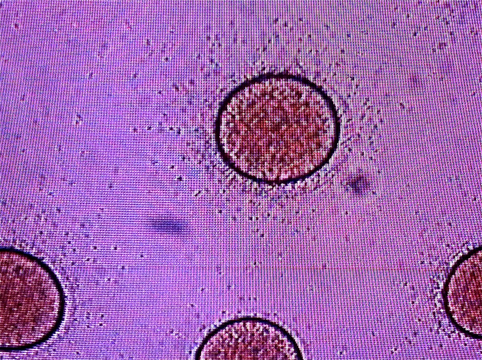 I Think Therefore I Blog: Echinoid Fertilization and Development Sea ...