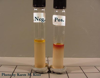 Indole Test: Principle, Procedure and results