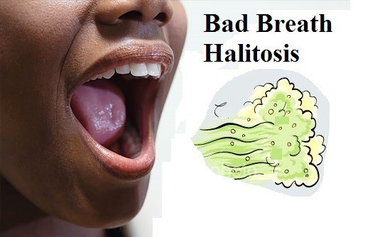 BAD BREATH/ HALITOSIS w - General Health Life