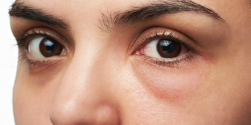 Blood Circulation and the Skin Part 1: How Increased Blood Circulation ...