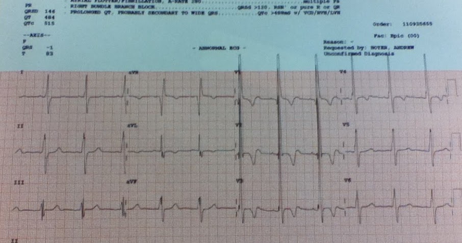 Jarod's Heart Journey: Living and Thriving with HLHS: Our Personal ...