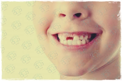 Se Te Ha Roto o Caído Un Diente, ¿Qué Hacer?