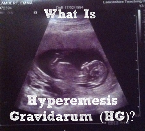 What Is Hyperemesis Gravidarum (HG)? - Sophie Ella and Me