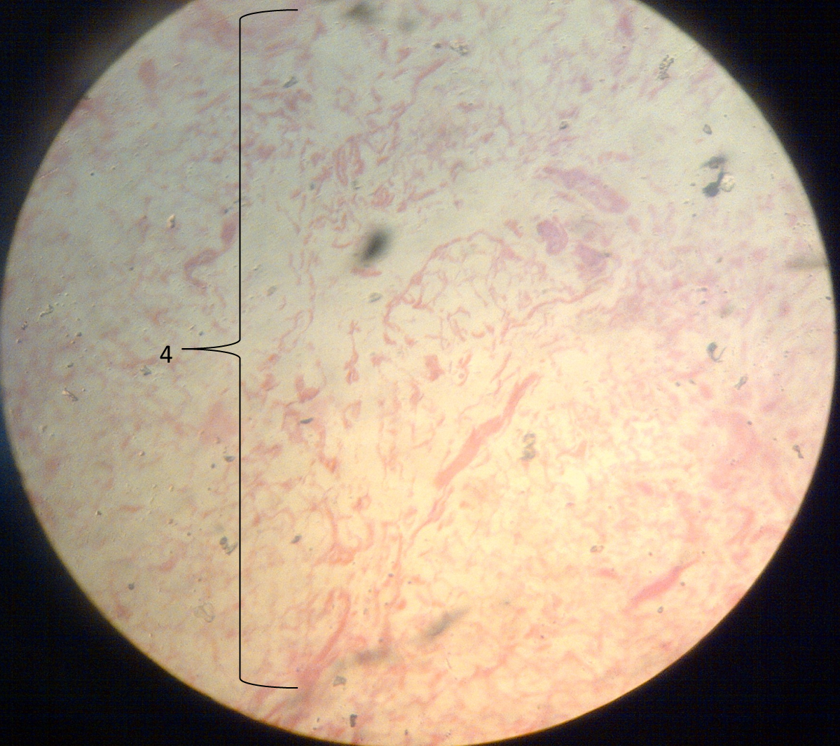 primeros pasos en medicina : Tejidos Conectivos