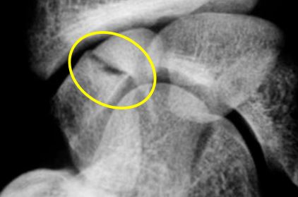 Un médecin du sport vous informe: 04.08.2013