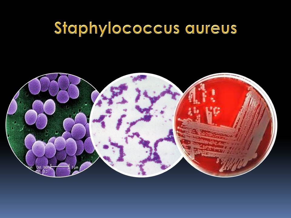 Staphylococcus Aureus Morphology Identification