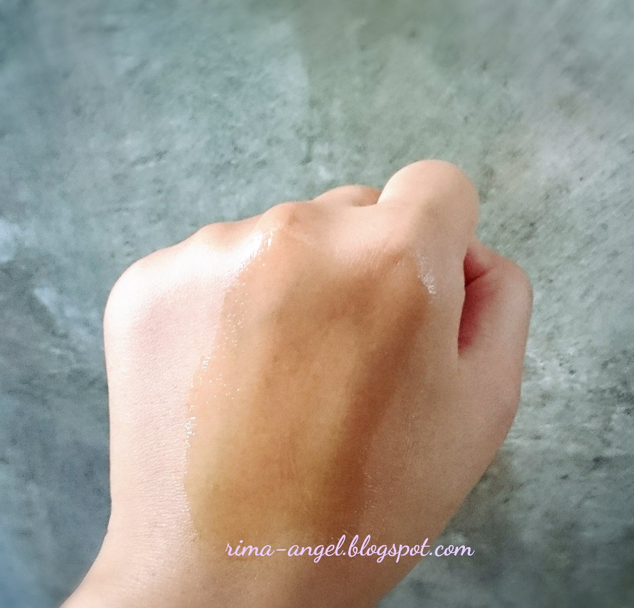 Review Medi-Klin TR Gel