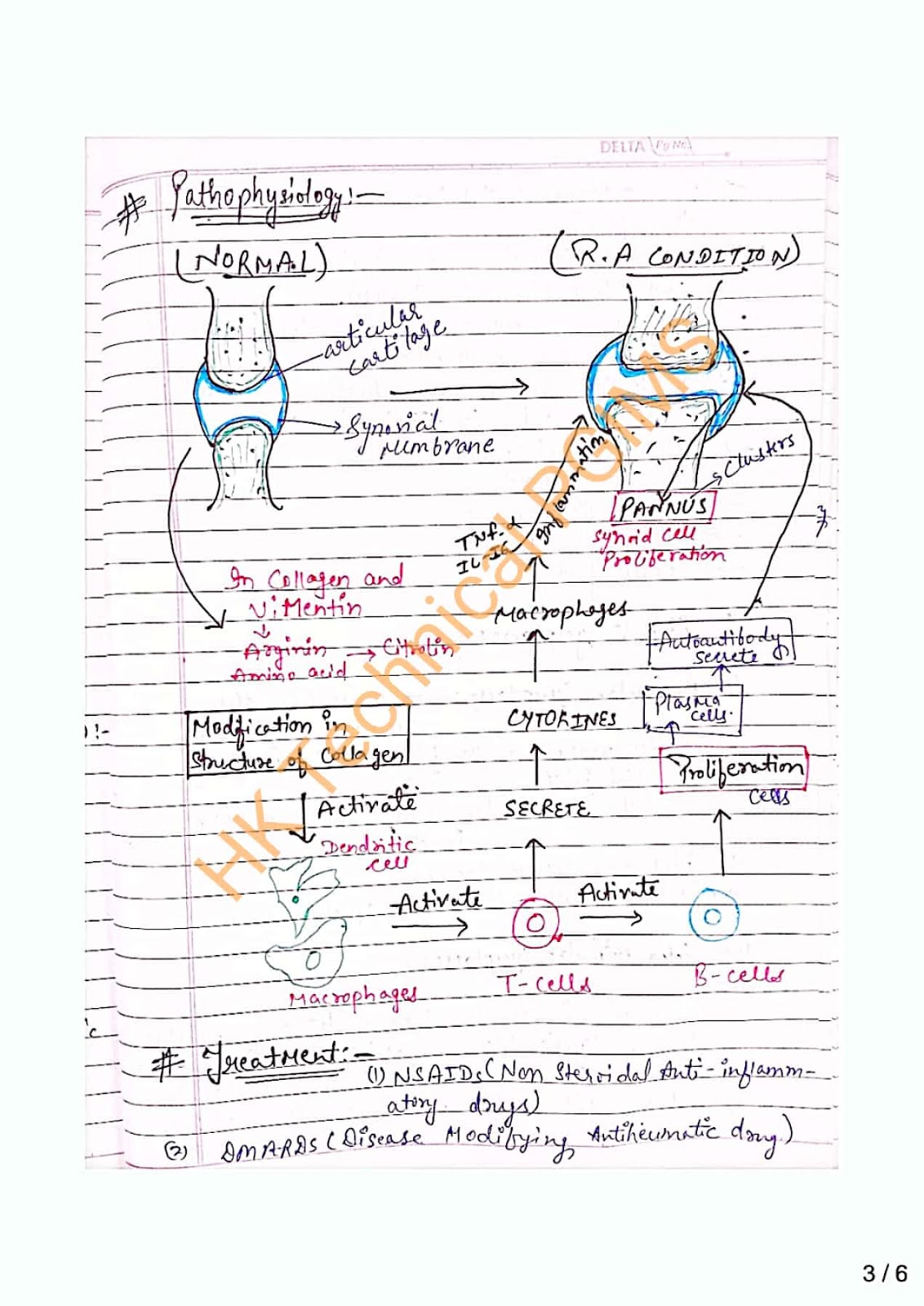 Rheumatoid Arthritis Pathophysiology Handwritten Notes Download PDF B ...