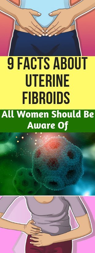 Here Are 9 Facts About Uterine Fibroids All Women Should Be Aware Of ...