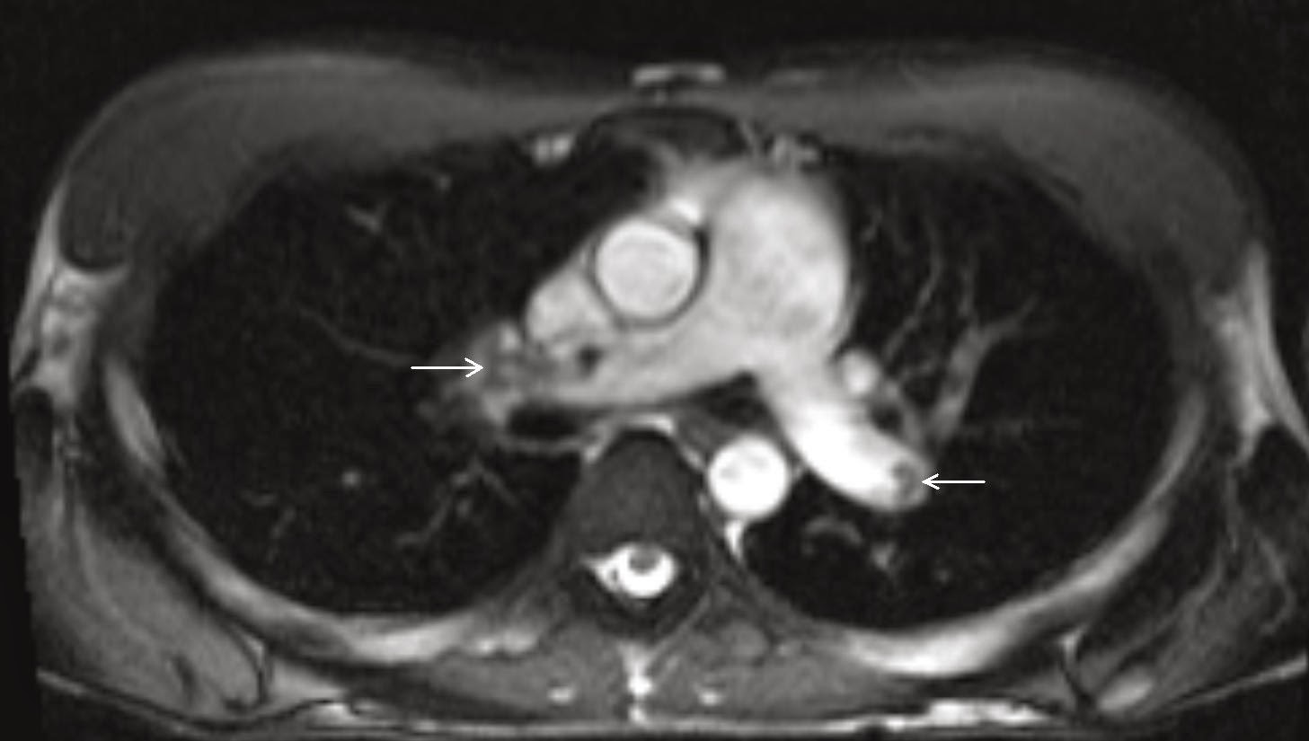 Chest Mri Order at Kelley Nichols blog