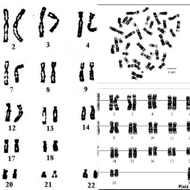 Techniques d'obtention du caryotype - techniques de Banding - Génétique ...