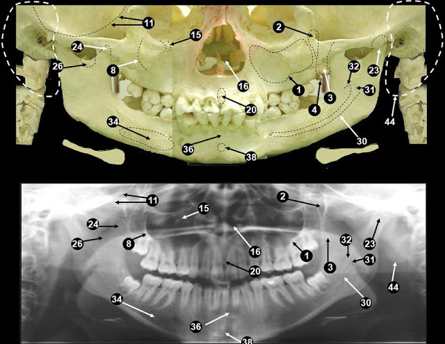 Tecnicos Radiologos: Ortopantomografia (Radiografia dental panorámica)