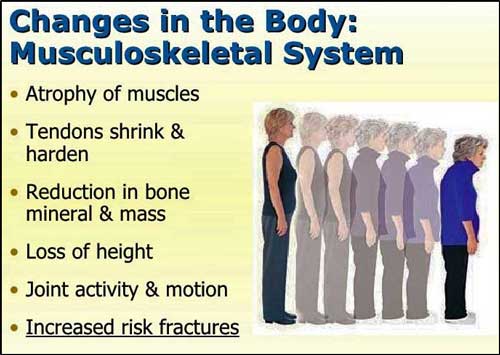 Retired--Now What?: I’m Shrinking!
