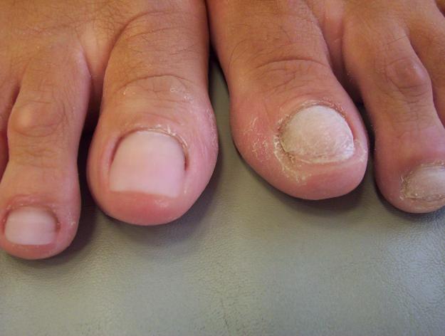 Atendimentos Podológicos | Bassi Podologia