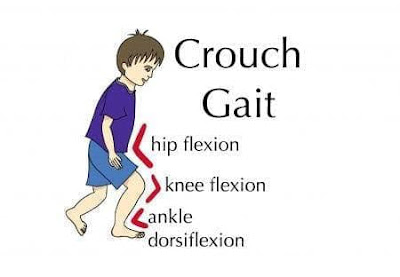 What is Crouch Gait