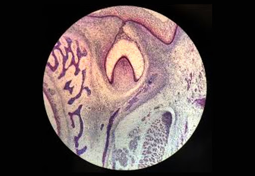 Odontogénesis: ¿Cómo se forma un diente? - OdontoVida