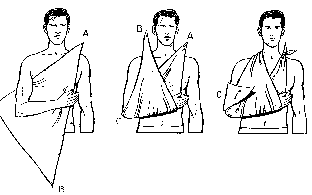 Primeros Auxilios: VENDAJES