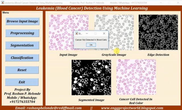 Matlab Code Leukemia Blood Cancer Detection Using Machine Learning Project Source Code | Final ...