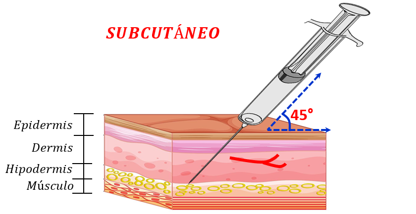 Tutor Geométrico.com: ÁNGULO DE APLICACIÓN DE UN INYECTABLE