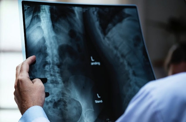 Frugal Finance: What is Radiology? An Ultimate Guide to Diagnostic Imaging