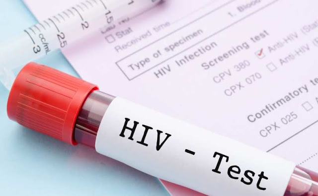 Conditions Of False Positive And False Negative Hiv Test