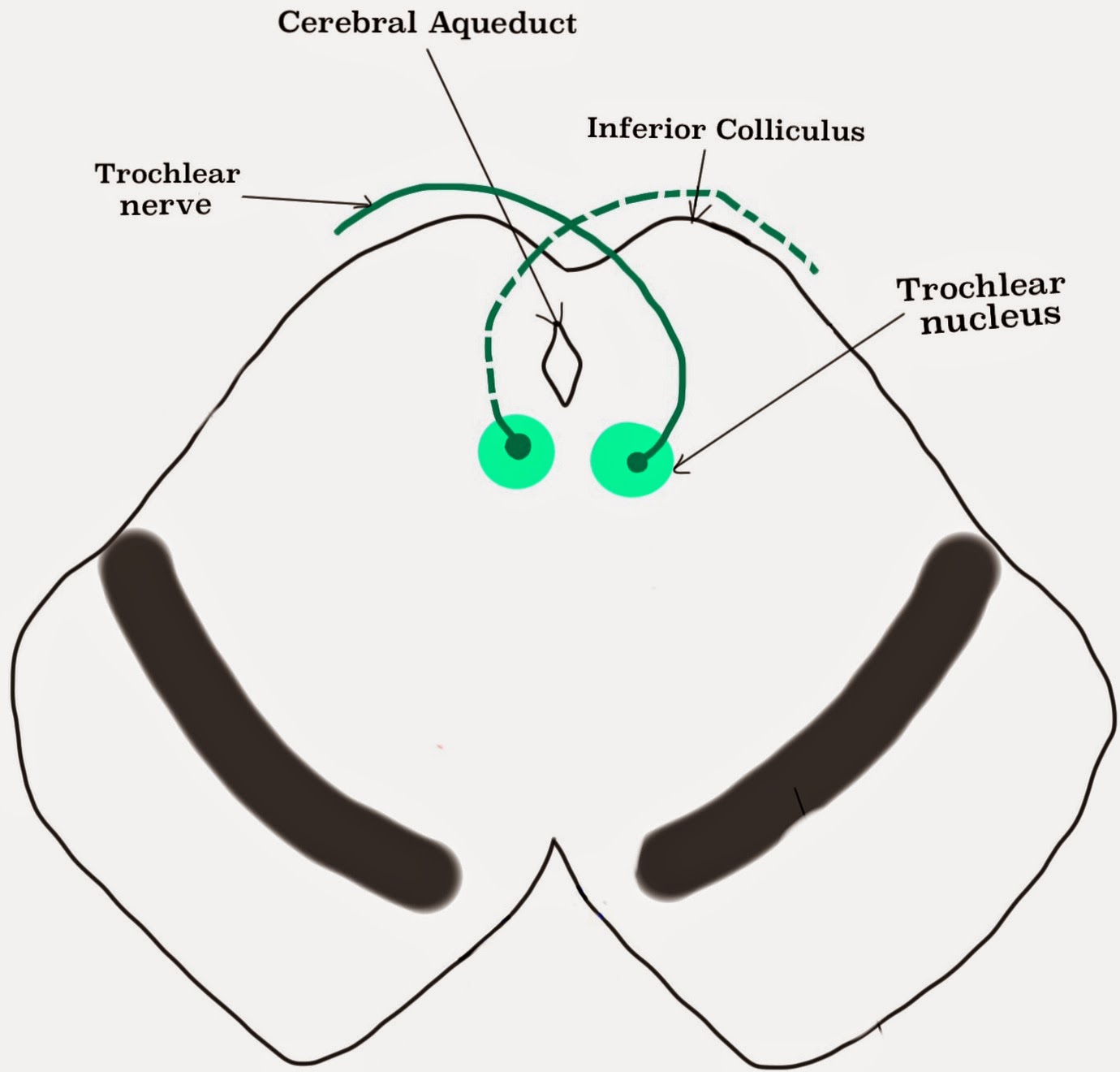 A Tale of Med Students: Trochlear Nerve – Cranial Nerve IV/4 (Easiest ...